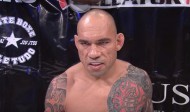 Evangelista “Cyborg” Fractured Skull at Bellator 158, Cris “Cyborg ...